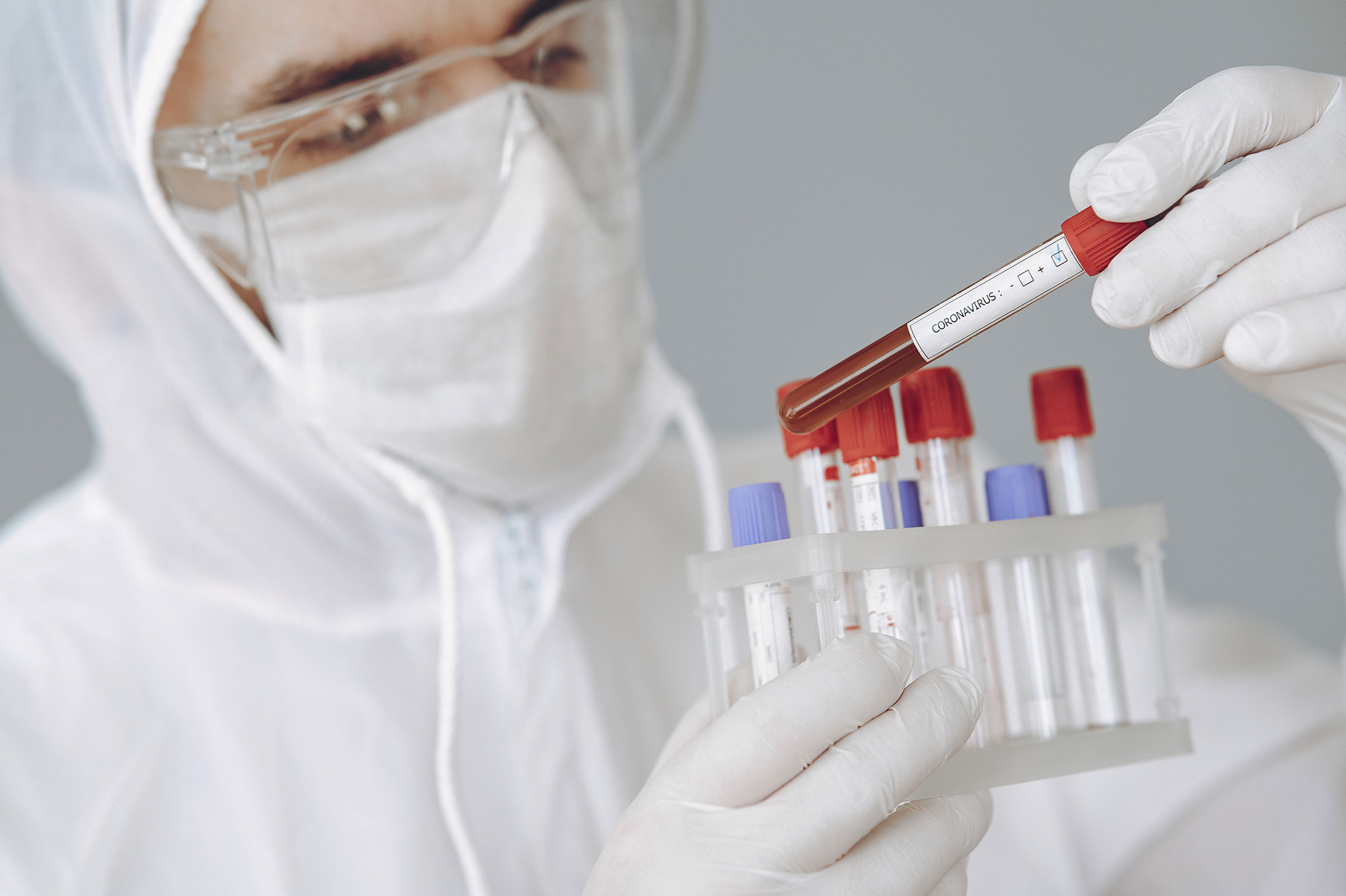 UCT to boost COVID-19 testing capability in SA | UCT News