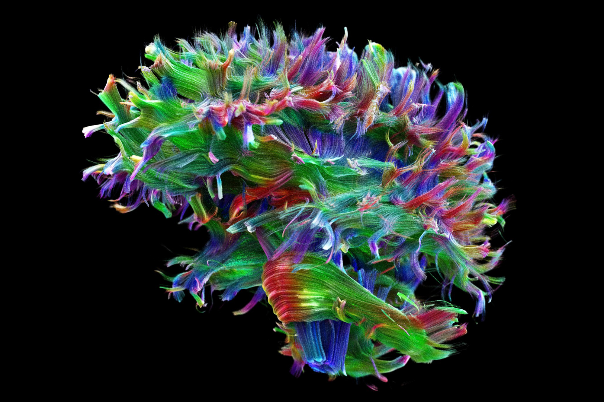 Neuroscience moves closer to understanding brain development | UCT News