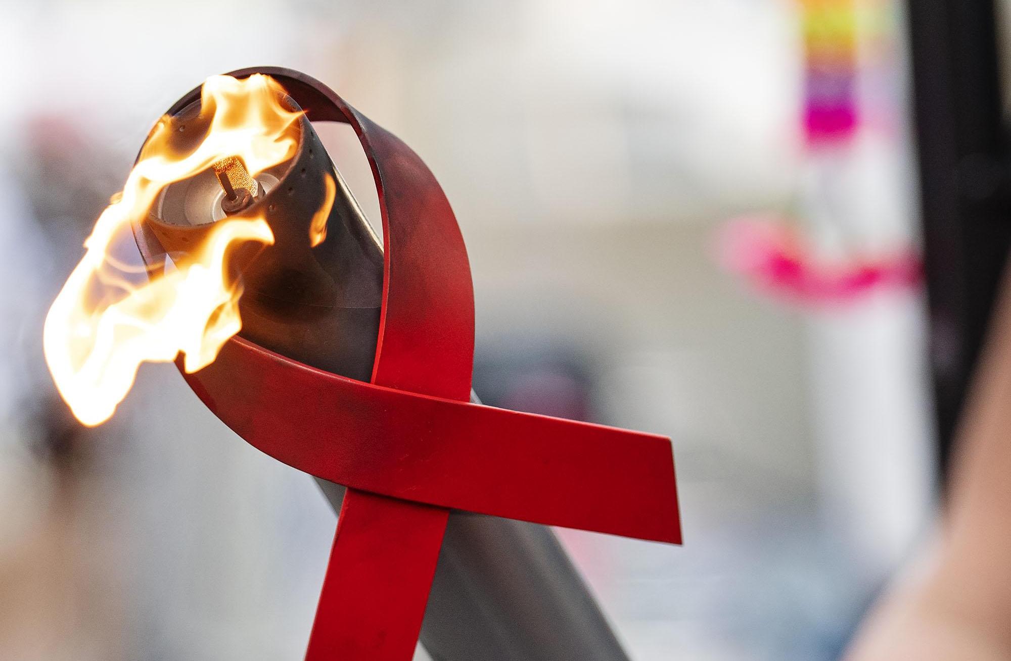 The HIV pandemic: time to recalibrate | UCT News